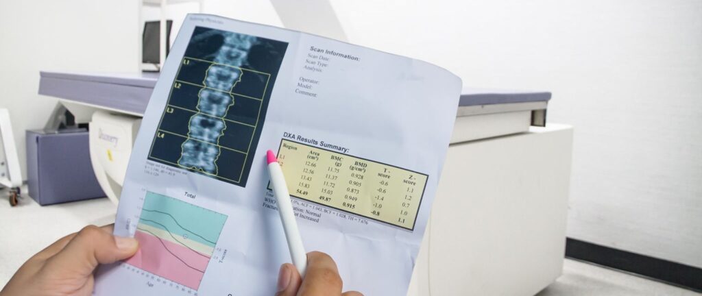 How Much Does a Dexa Scan Cost in the USA? | Bodiatrics